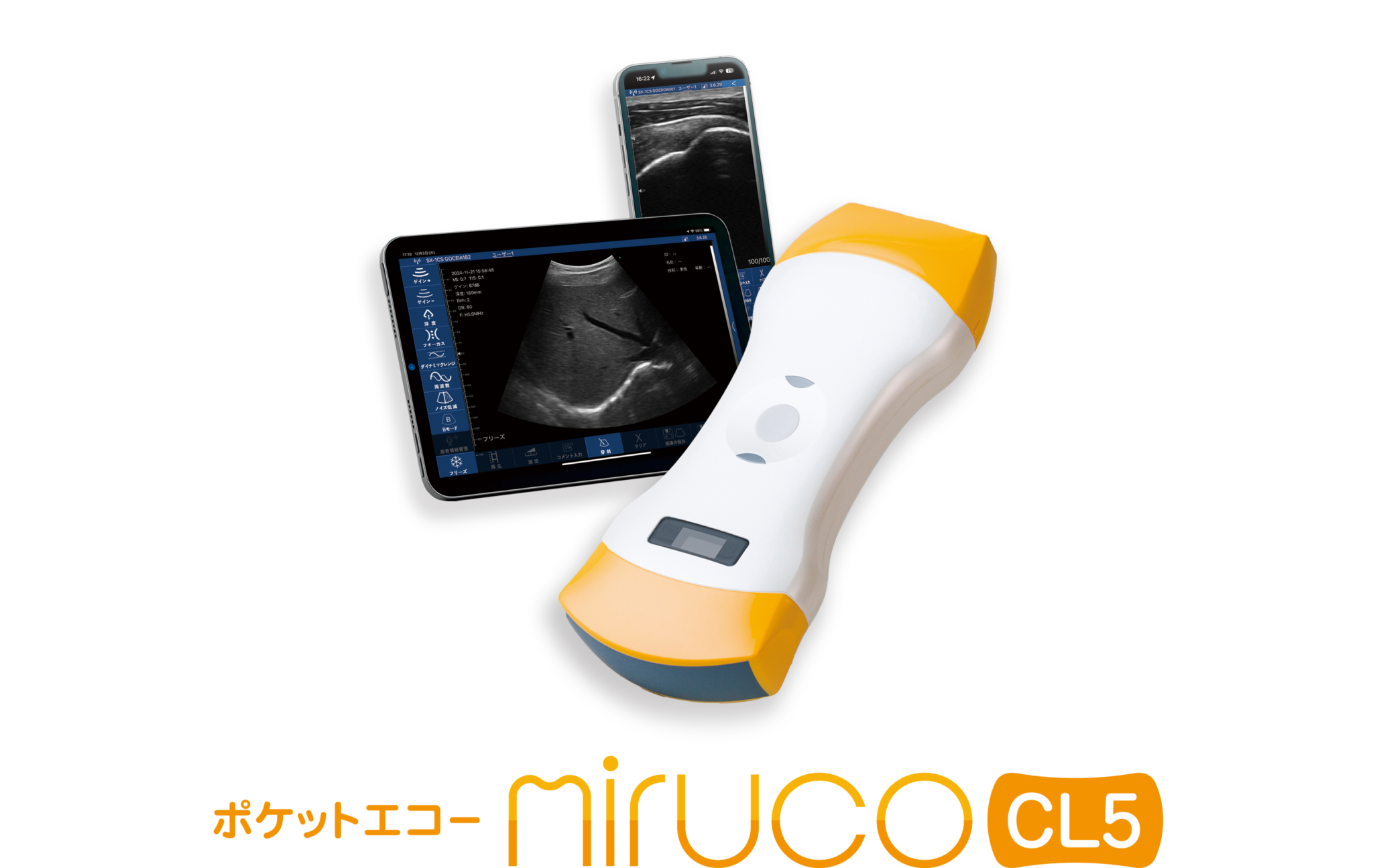 超音波画像診断装置「ポケットエコー miruco CL5」を2月3日(月)より新たに発売します。｜日本シグマックス株式会社 コーポレートサイト